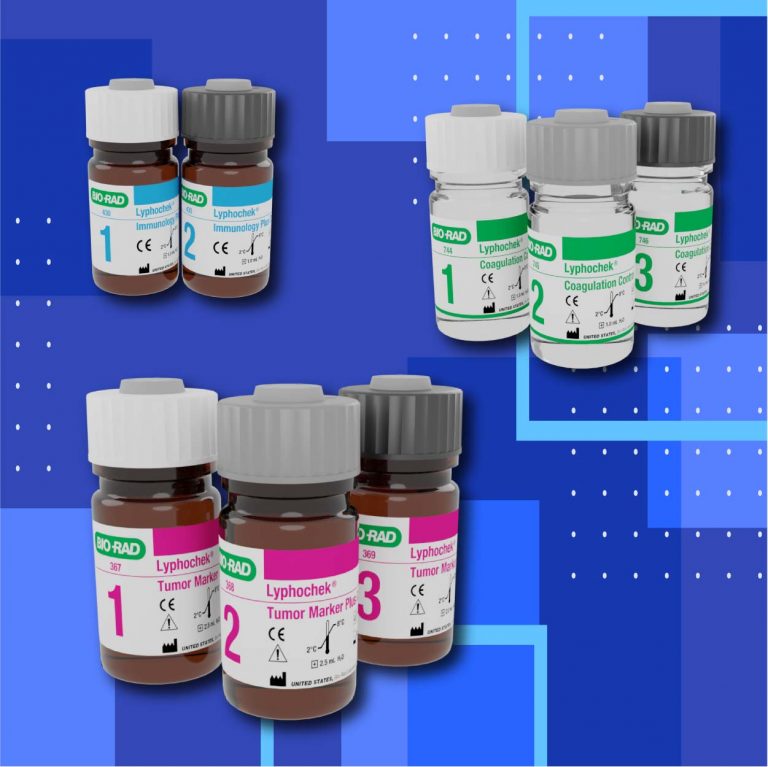 Control de calidad interno – Quik Quality is The Key